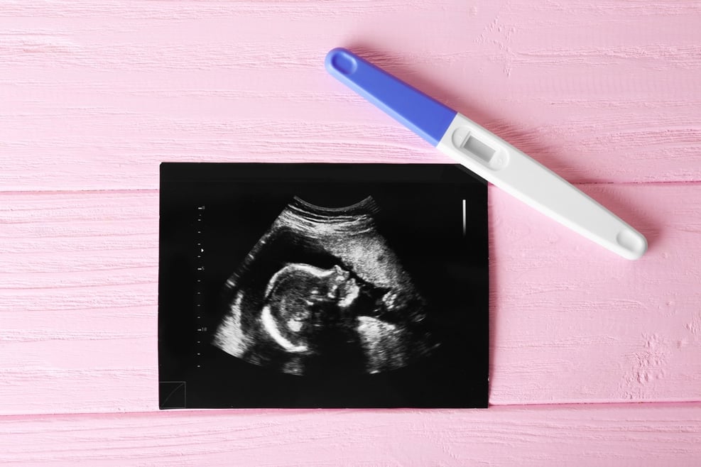 Implantation After IUI: Symptoms to Look for and What to Expect